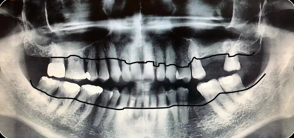 Periodontal & Non-Periodontal Patient – Differences in screening ...